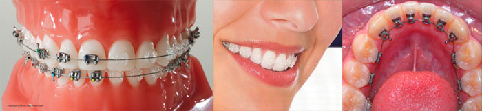 CentroDent - Tratamientos